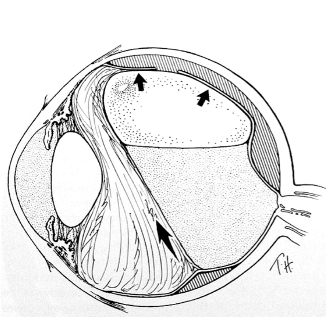 OE | Physicians – Changing the way ophthalmic professionals keep their ...